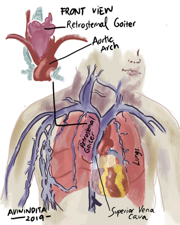 Facial Plethora (Causes and Mechanisms) – My Endo Consult