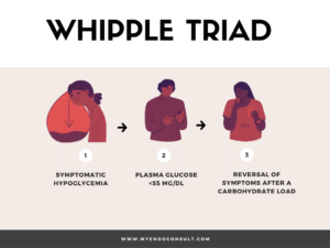 Whipple’s Triad – My Endo Consult